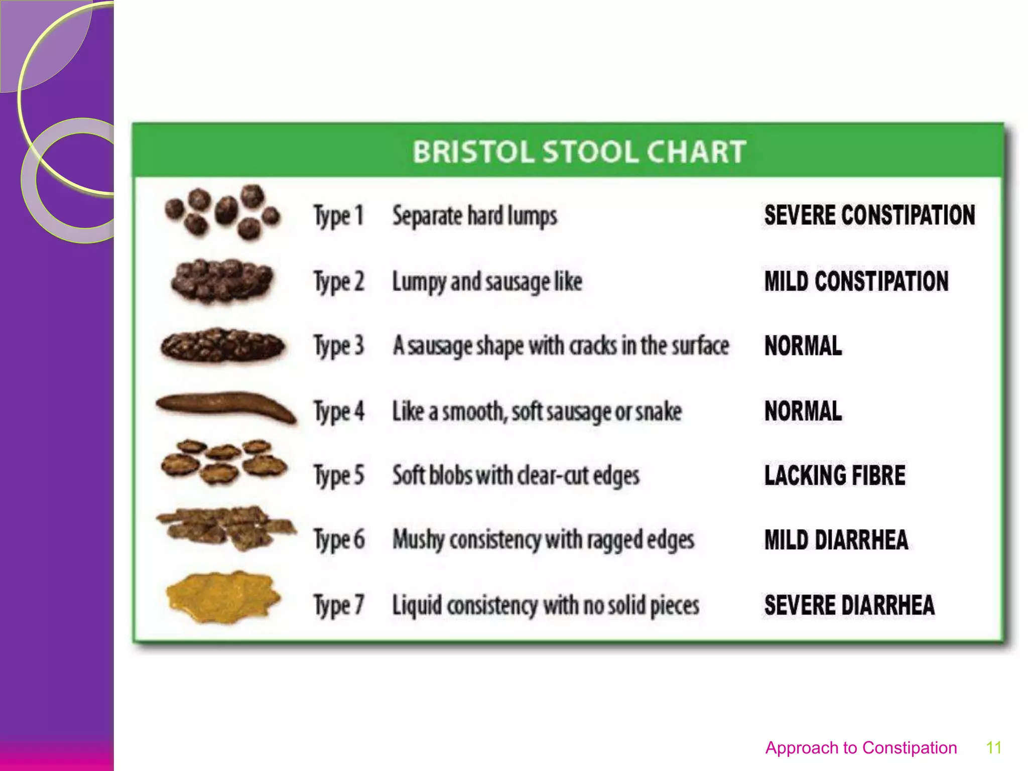 Approach to a child with Constipation | PPTX