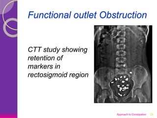 Approach to a child with Constipation | PPTX