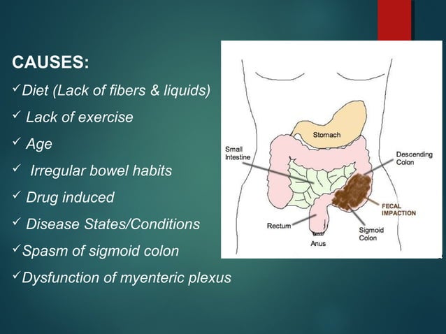 laxatives | PPT | Digestive Disorders | Diseases and Conditions