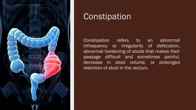 Constipation easy explanation | PDF