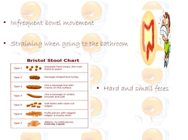 Constipation | PPT