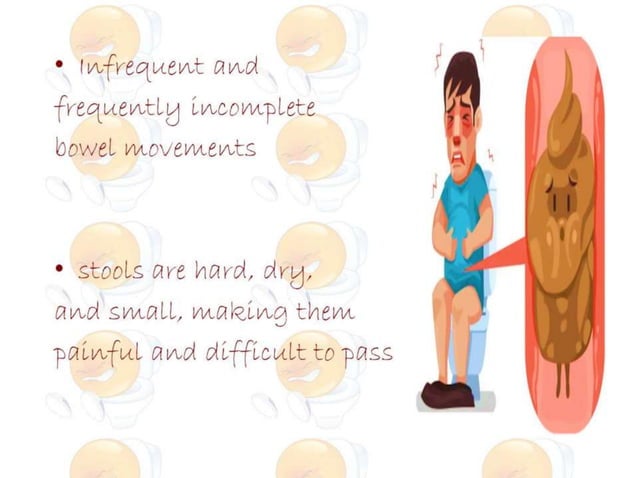 Constipation | PPT