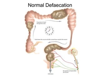 Constipation and Pelvic Floor Disorders.pptx