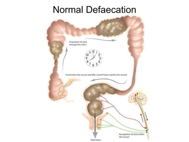 Constipation and Pelvic Floor Disorders.pptx