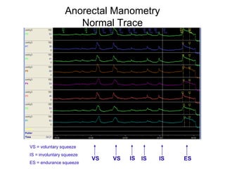 Constipation and Pelvic Floor Disorders.pptx