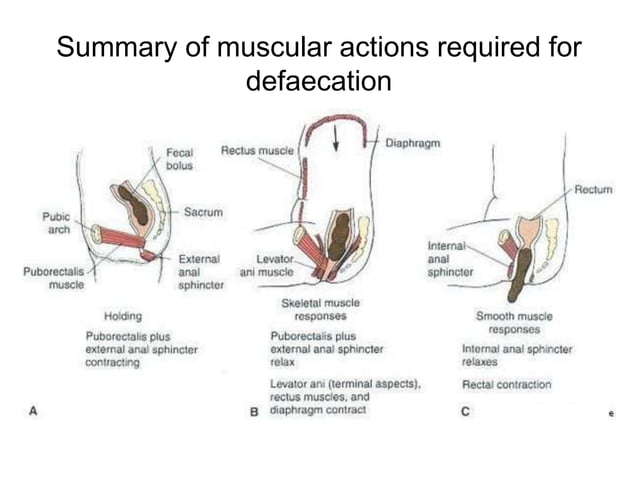 Constipation and Pelvic Floor Disorders.pptx