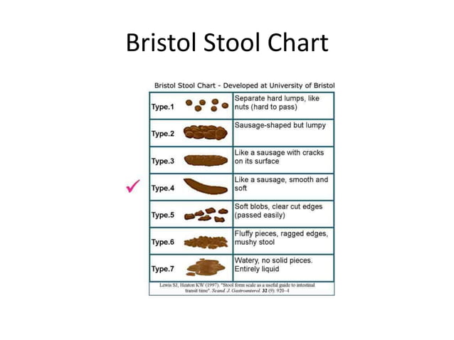 Constipation_in_Children-1.ppt