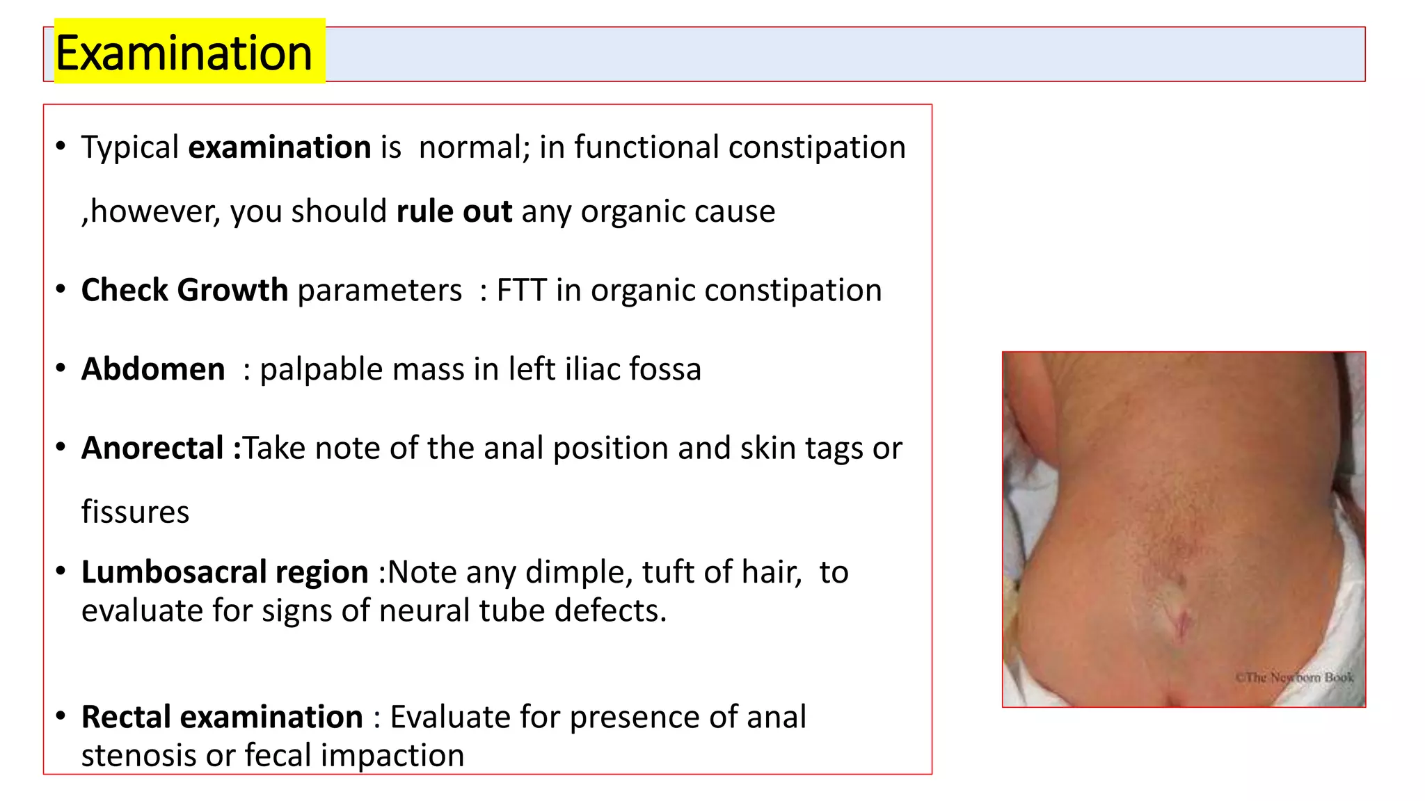 Constipation in children | PPTX