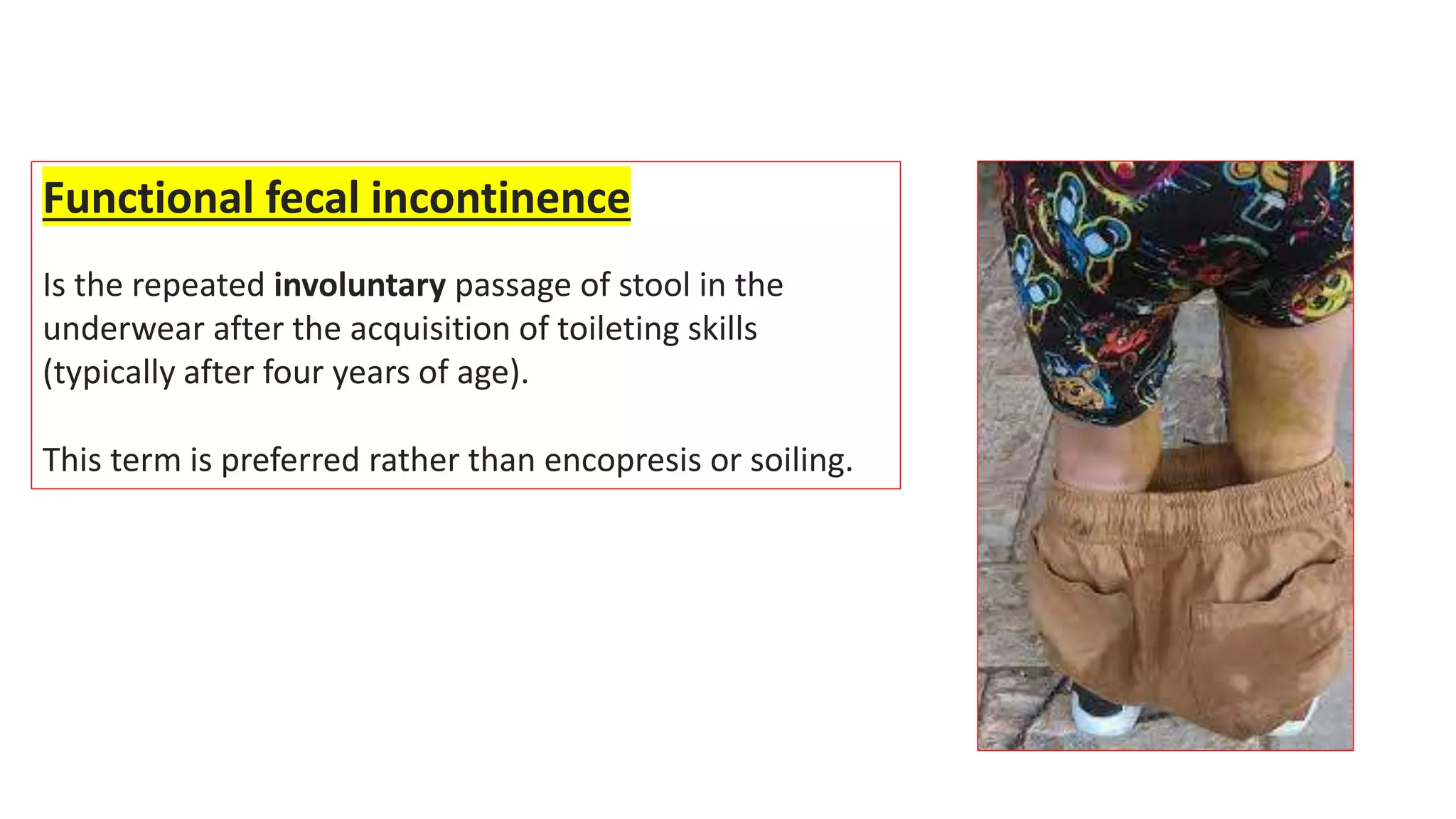 Constipation in children | PPTX