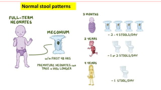 Constipation in children | PPTX