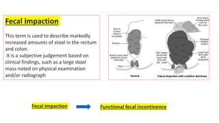 Constipation in children | PPTX