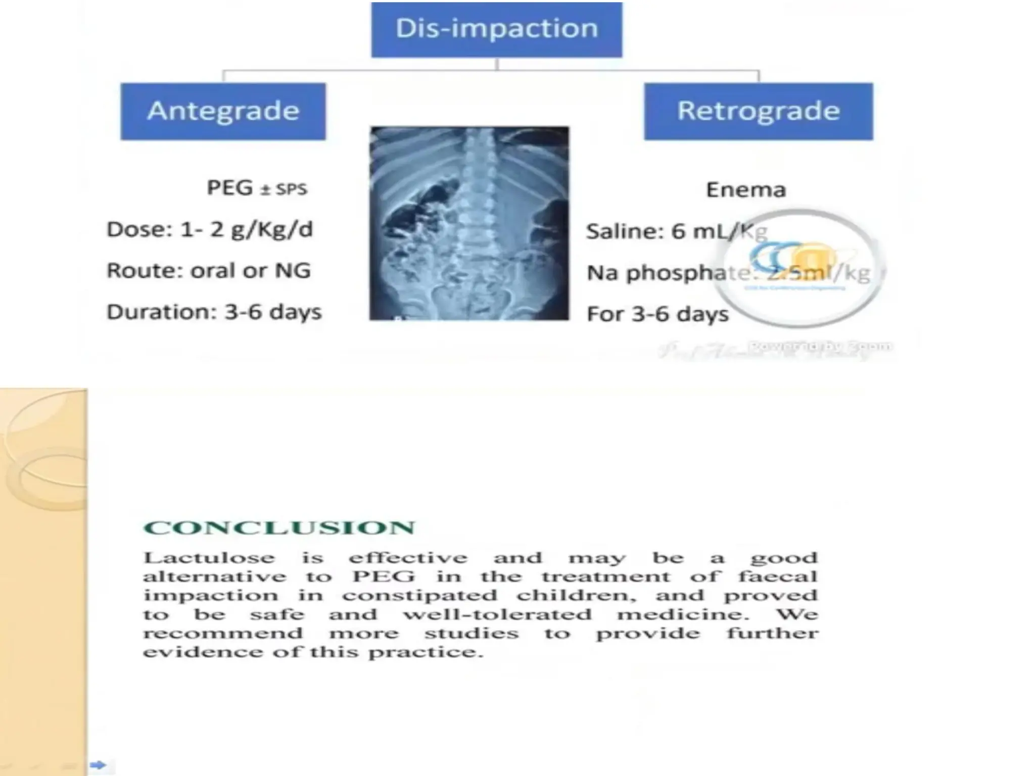 Approach to constipation in children.pdf