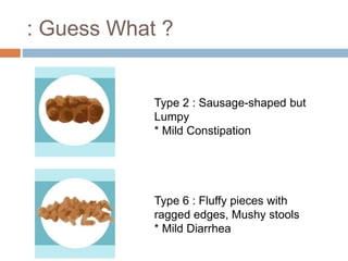 Constipation in Elderly | PPTX