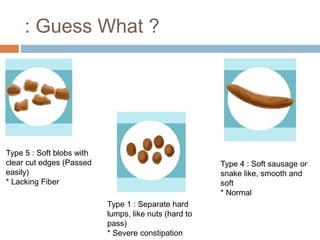 Constipation in Elderly | PPTX