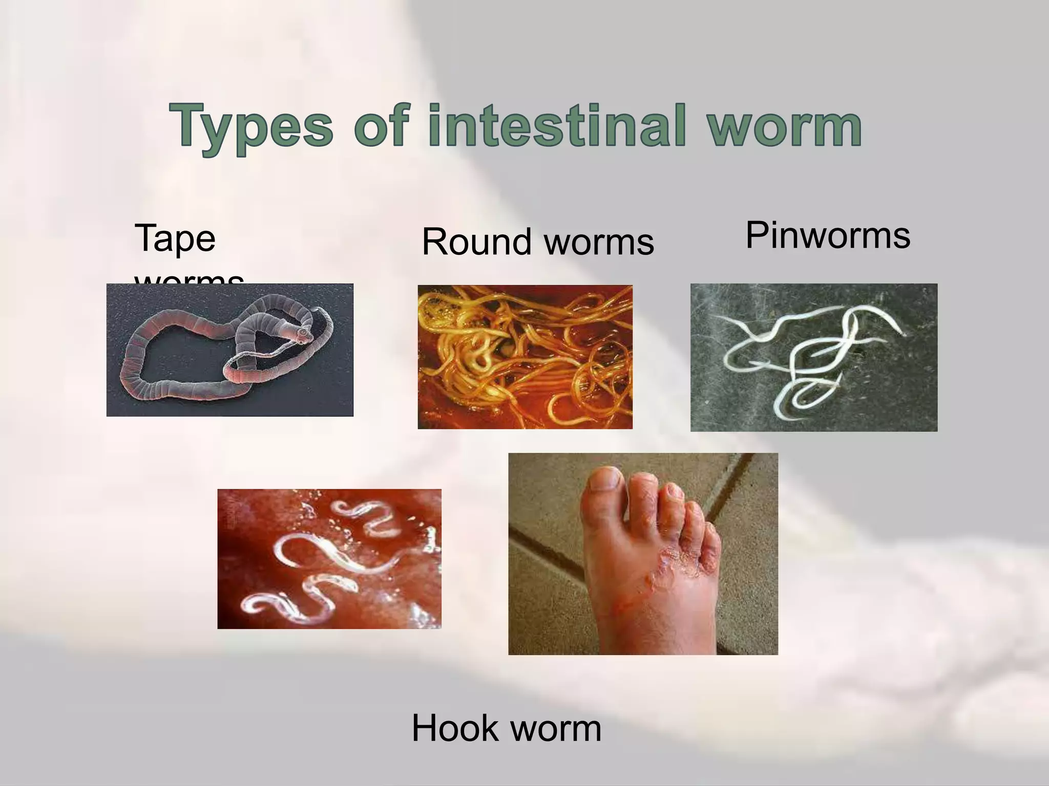 Constipation & worm infestation.pptx