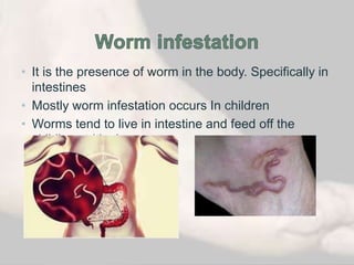 Constipation & worm infestation.pptx