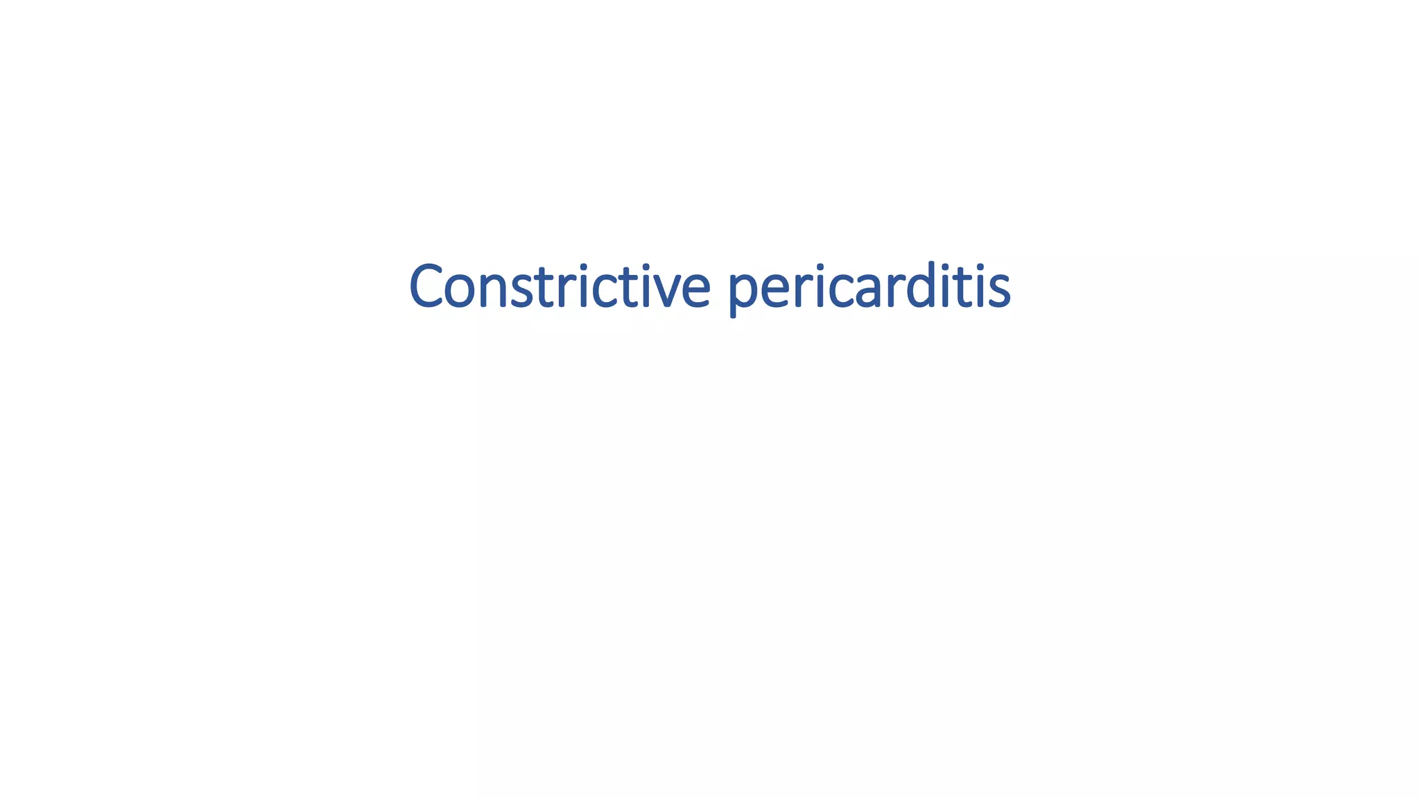 Constrictive pericarditis | PPTX