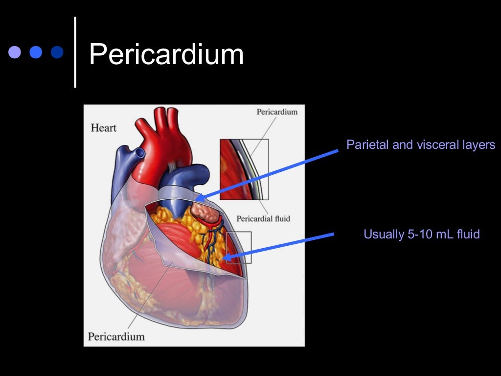 Constrictive pericarditis