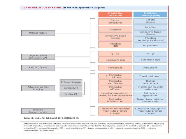 Constrictive pericarditis pathophysiology | PPTX