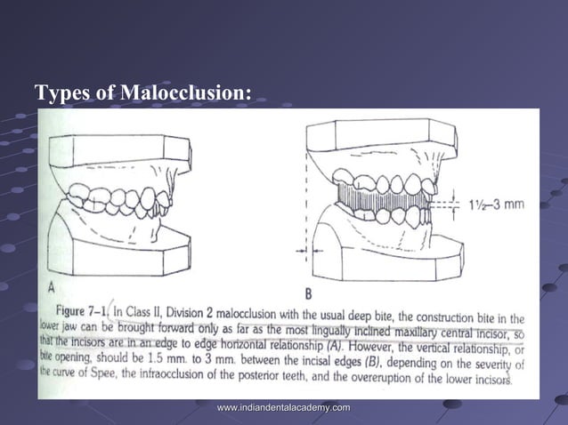 Construction of bite for various functional orthodontic appliances ...