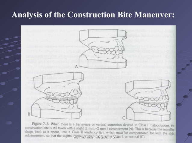 Construction of bite for various functional orthodontic appliances ...