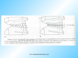 Construction bite (2) | PPT