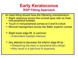 contact lenses fitting for KCN | PPT