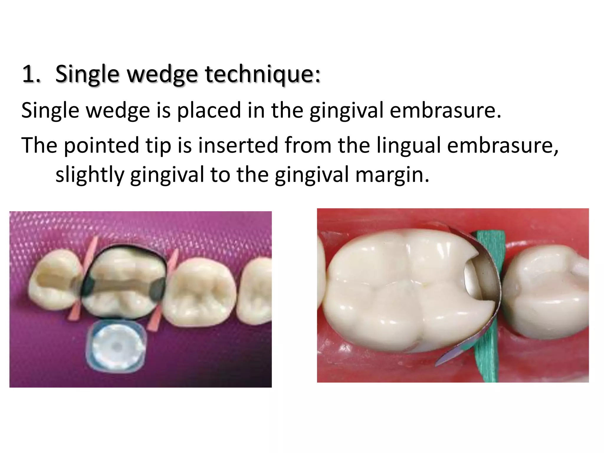 Contact and contours | PPTX