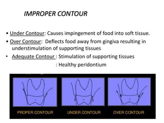 Contact and contours | PPTX