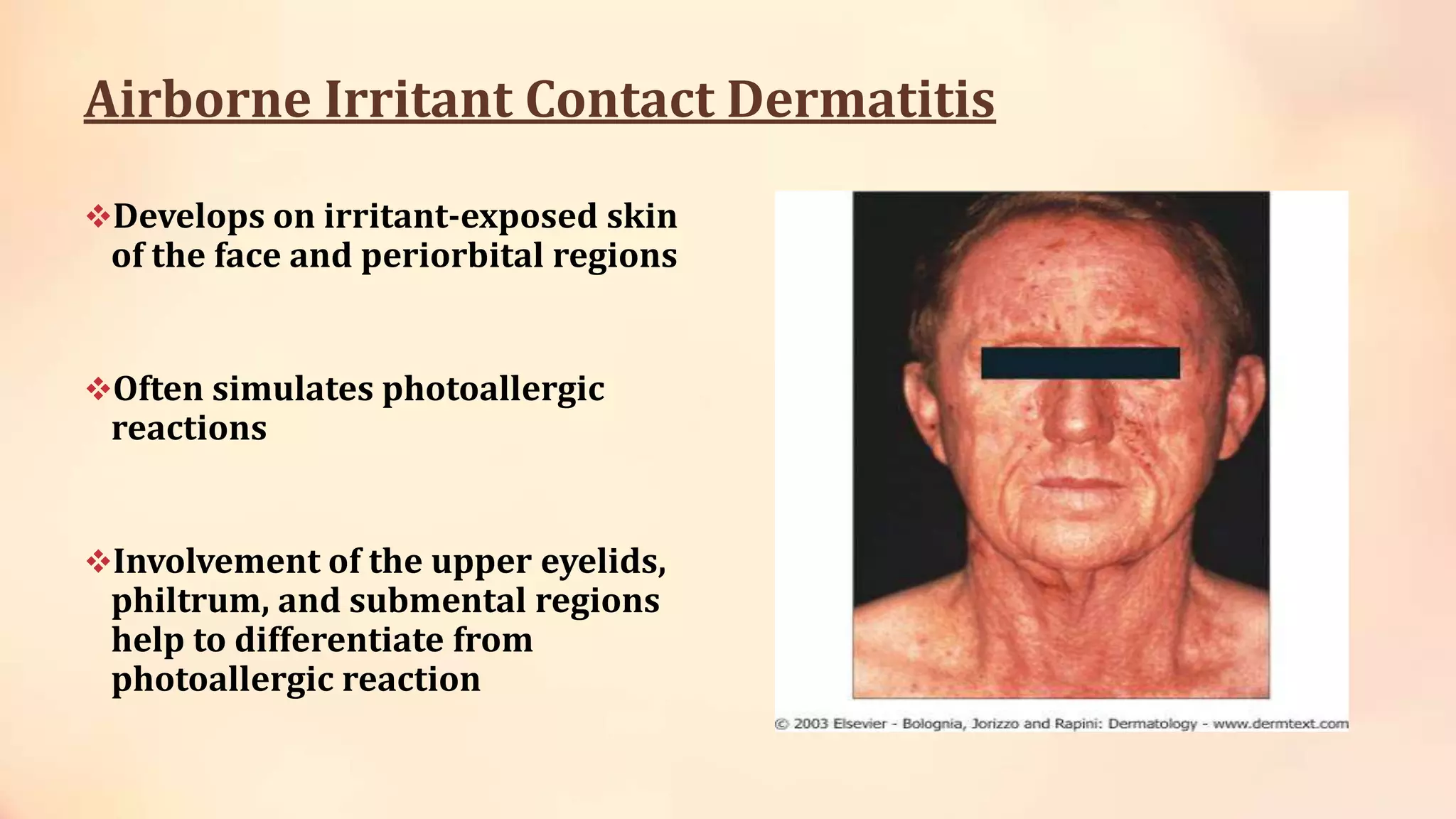 Contact dermatitis | PPTX