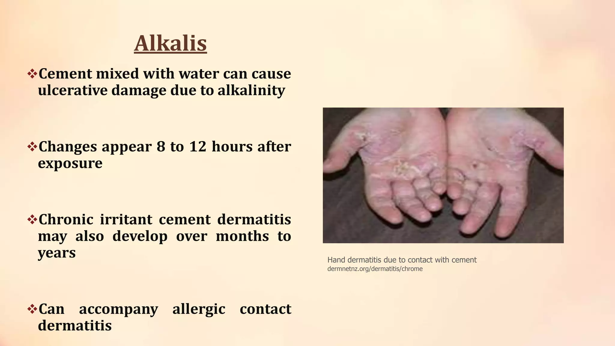 Contact dermatitis | PPTX