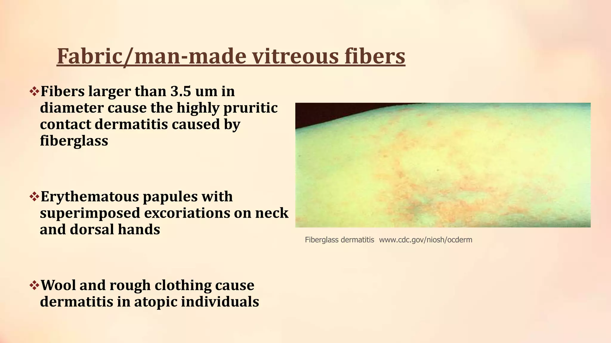 Contact dermatitis | PPTX