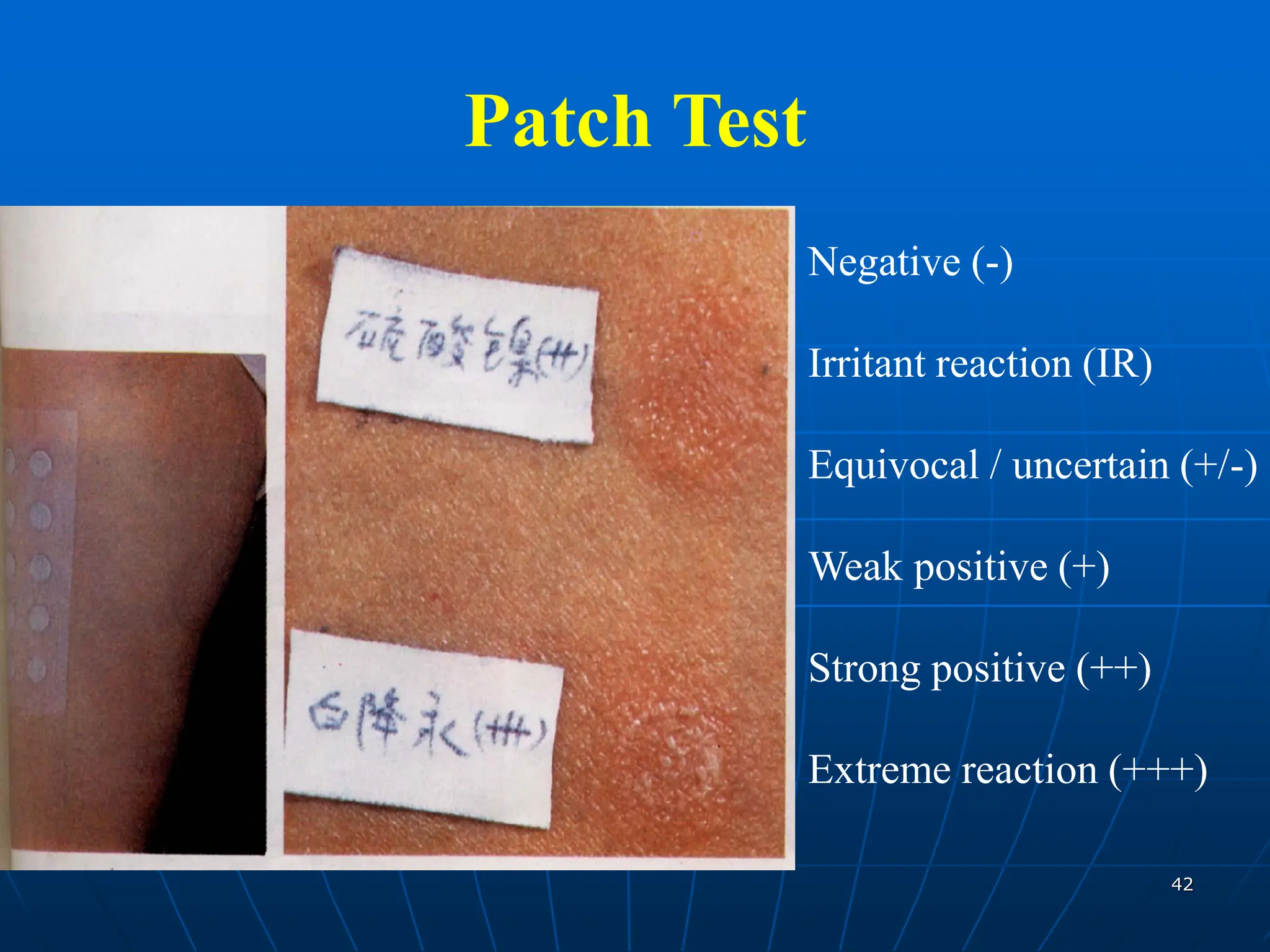 contact dermatitis in adults and children.ppt
