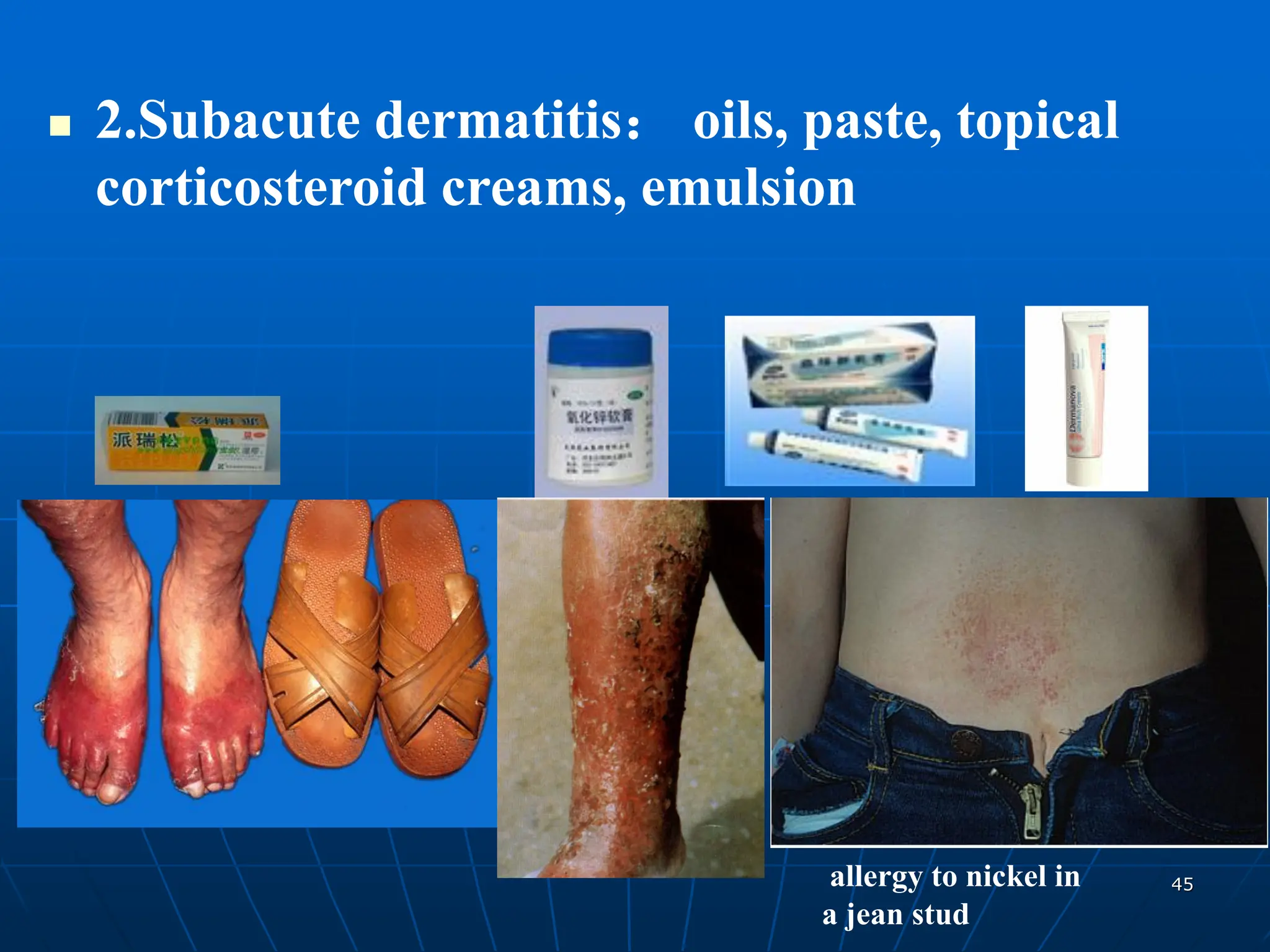 contact dermatitis in adults and children.ppt