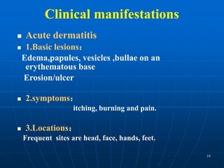 contact dermatitis in adults and children.ppt