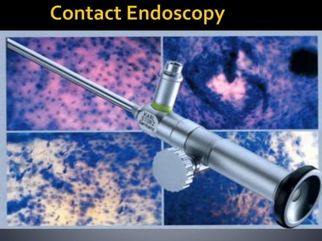 Contact and Compact Endoscopy in ENT | PPTX | Ear, Nose and Throat ...