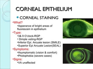 Contact lens complication | PPT