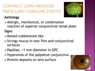 Contact Lens Complications-P82502 | PPTX