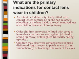 contact lenses in children[1].pptx