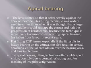 Contact lens fitting in keratoconus copy | PPTX