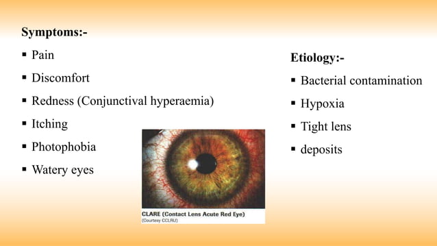 CONTACT LENS INDUCED ACUTE RED EYE.pptx