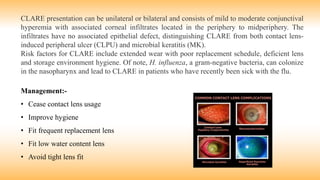 CONTACT LENS INDUCED ACUTE RED EYE.pptx