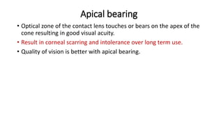 Contact lens in keratoconus 2 | PPTX