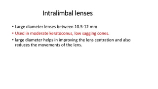 Contact lens in keratoconus 2 | PPTX