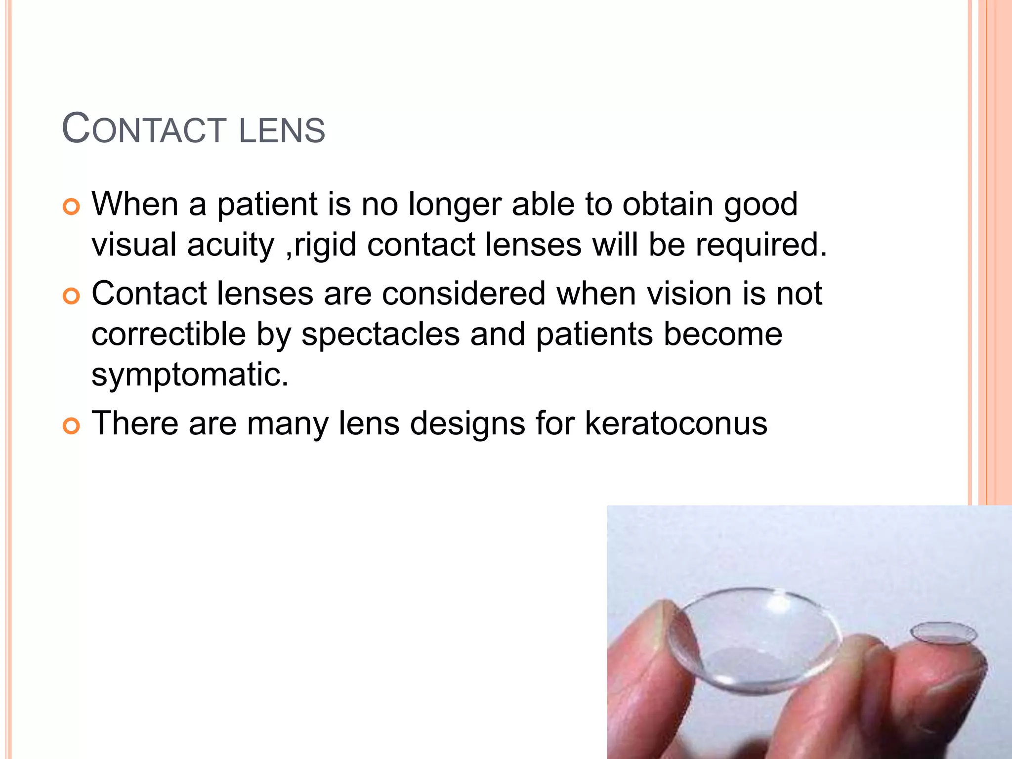 Contact Lens Options In Keratoconus Patients | PPTX