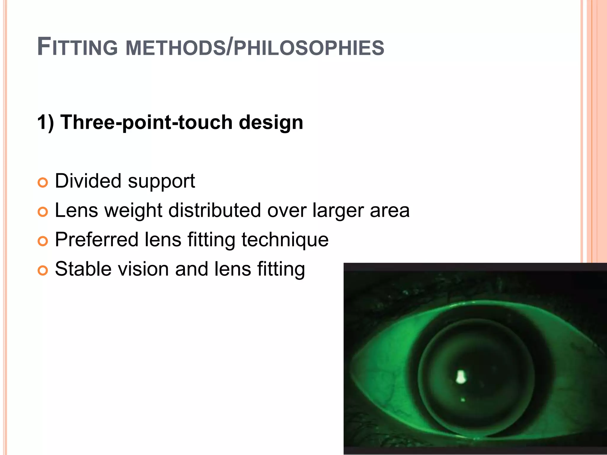 Contact Lens Options In Keratoconus Patients | PPTX