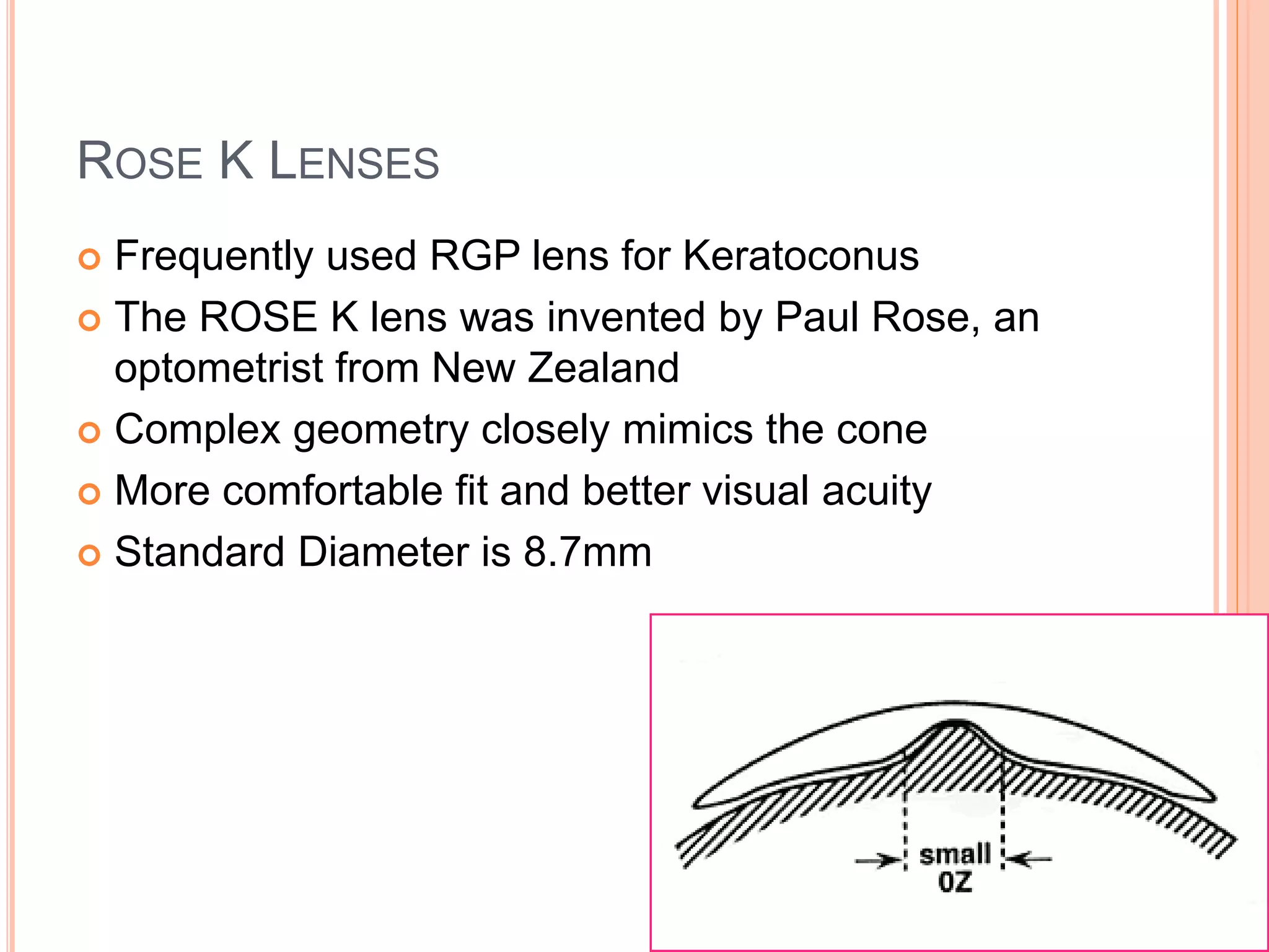 Contact Lens Options In Keratoconus Patients | PPTX