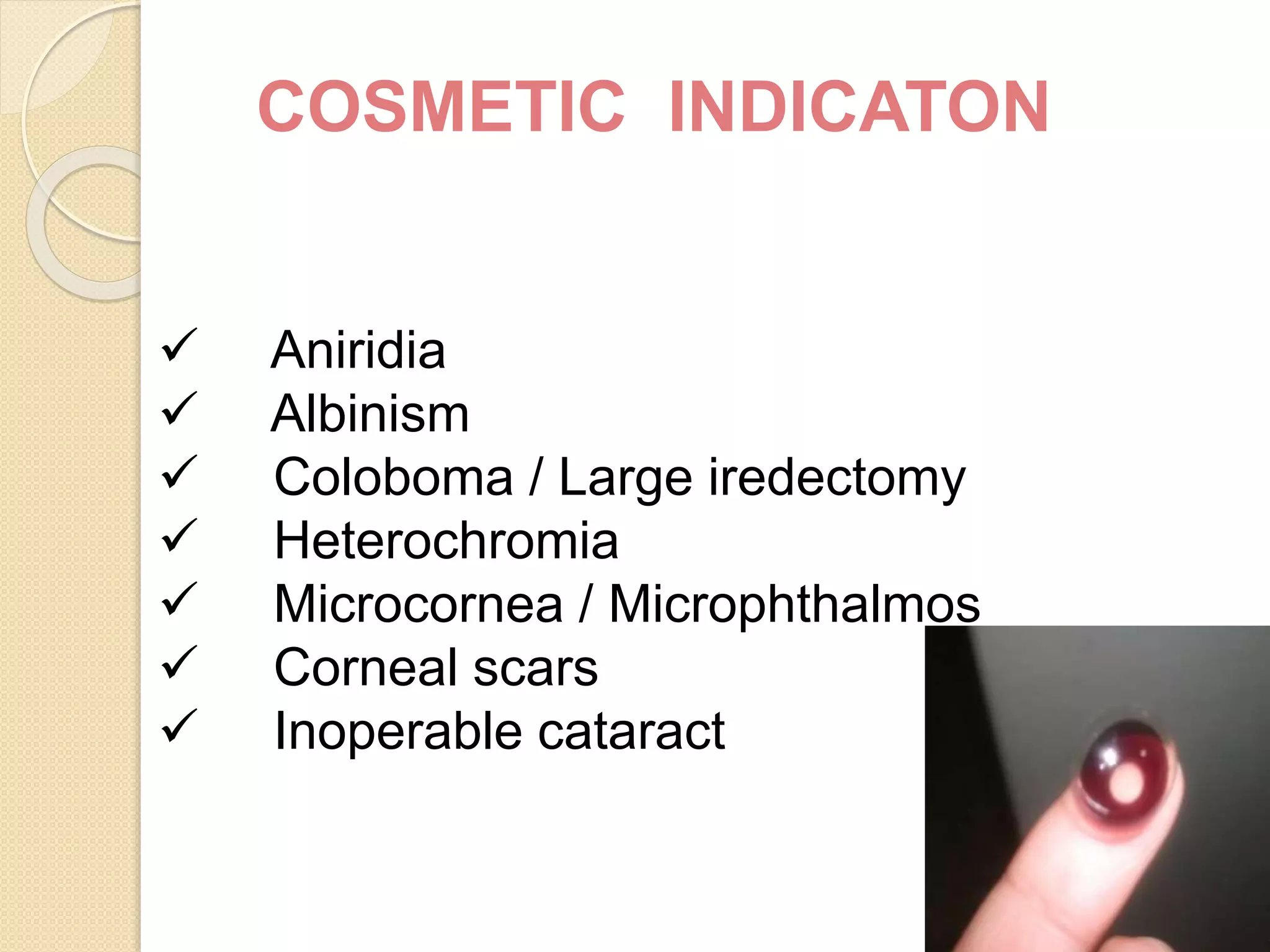 Contact lenses in Ophthalmology | PPTX