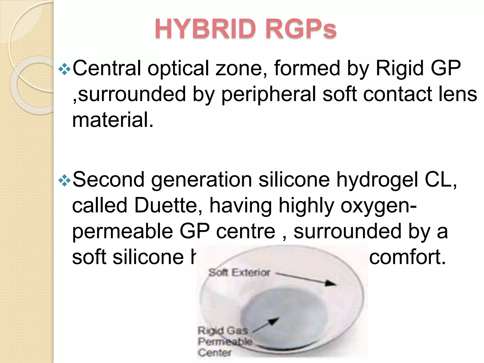 Contact lenses in Ophthalmology | PPTX