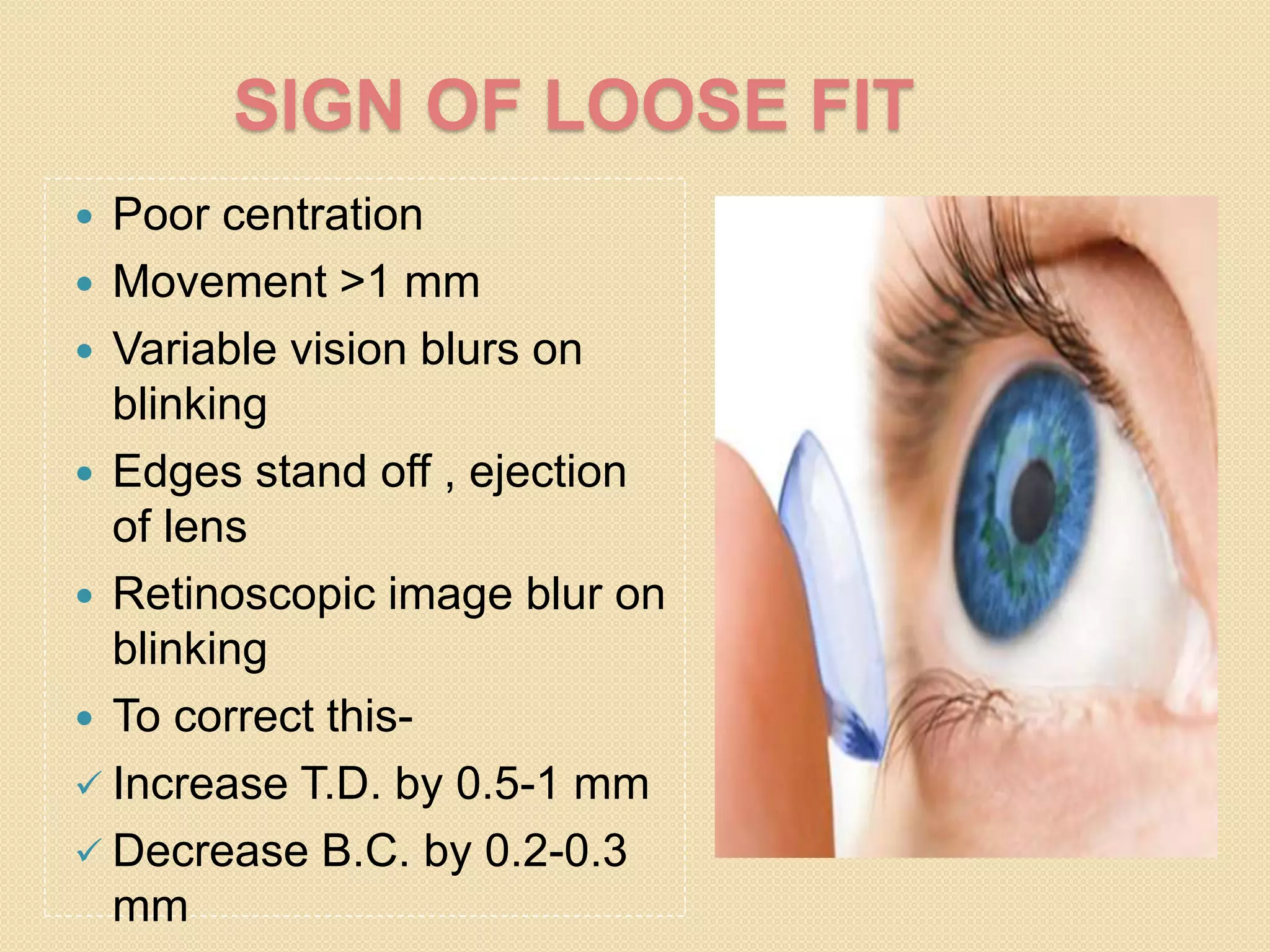 Contact lenses in Ophthalmology | PPTX